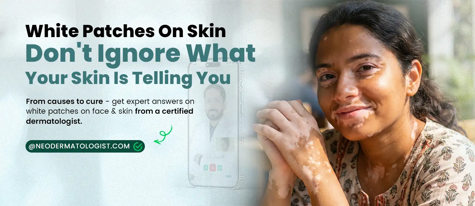 White Patches on Skin: Causes, Types & When to See Dermatologist