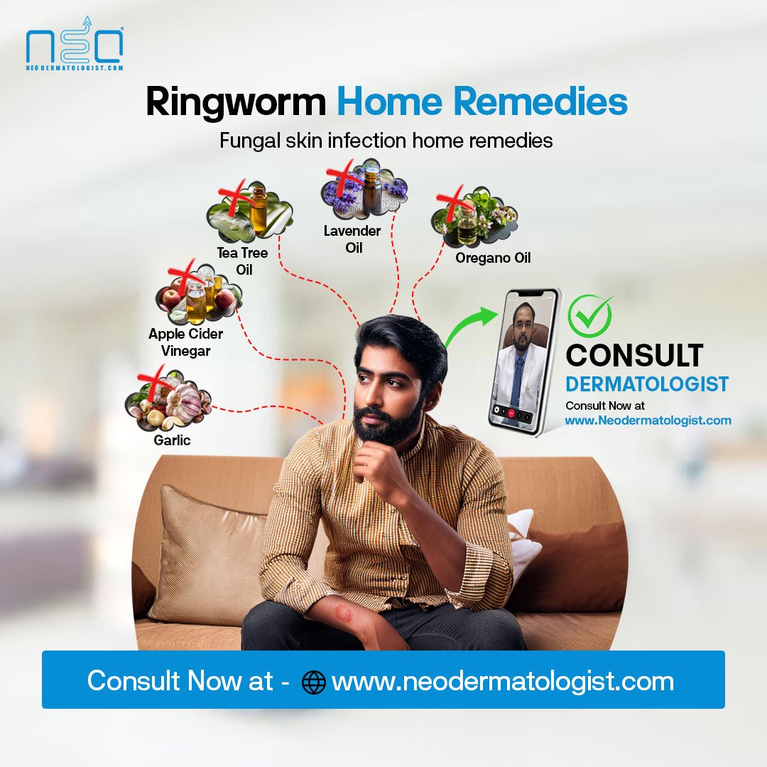 Ringworm Infection Treatment Online, Ringworm Dermatologist Online